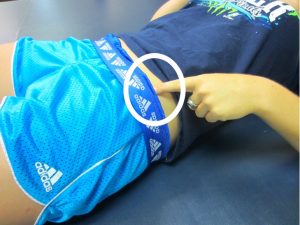 Hip Pointer | Dr Geier