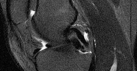 Should I get an xray or MRI? | Dr Geier