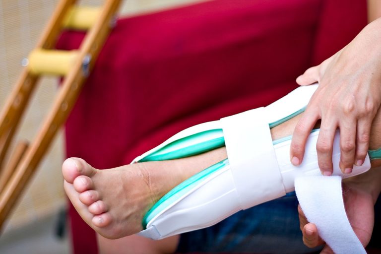 Sprained ankle: Mechanism of injury, diagnosis and initial treatment of ...