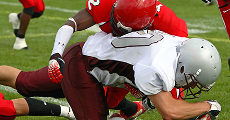 SC dislocation: Mechanism of injury and treatment of a sternoclavicular ...