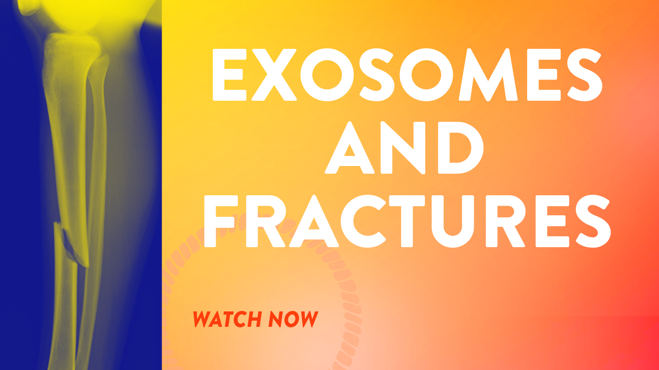 Exosomes and fractures | Dr Geier